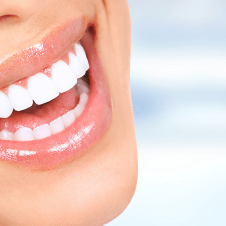 Deep Cleaning Teeth Aftercare - What You Need To Know